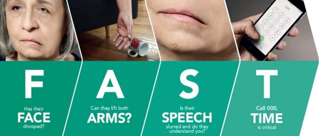 Stroke-The Different Faces • Bariboost