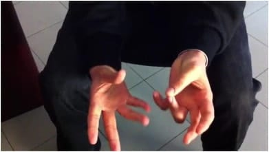 Mirror Movement Disorder (MMD)- A Case Study. • Bariboost